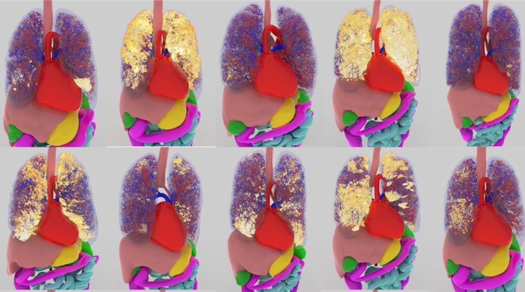 Center for Virtual Imaging Trials | A National Center for Biomedical ...