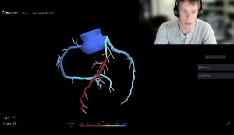 Past, Present and Future Technology at HeartFlow - CVIT - Center for ...