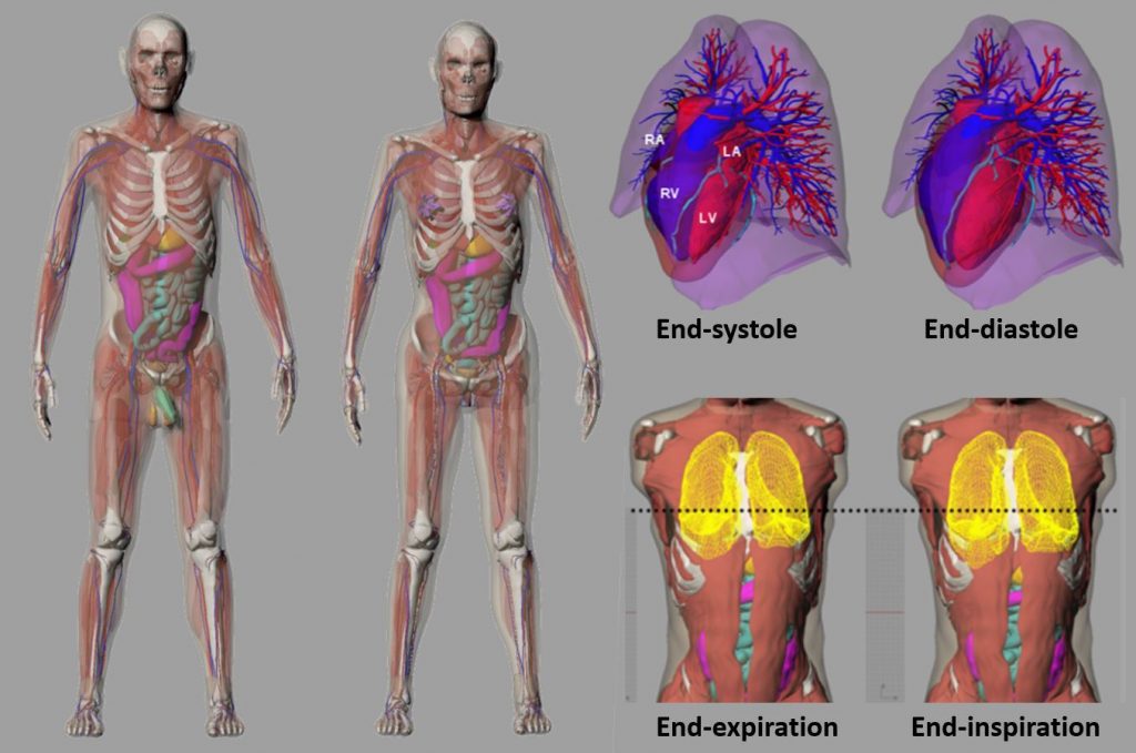 XCAT Phantom Program - CVIT - Center for Virtual Imaging Trials