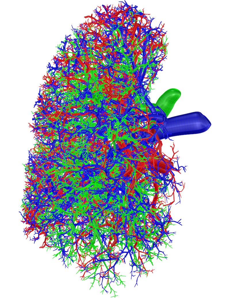 About CVIT - Center for Virtual Imaging Trials
